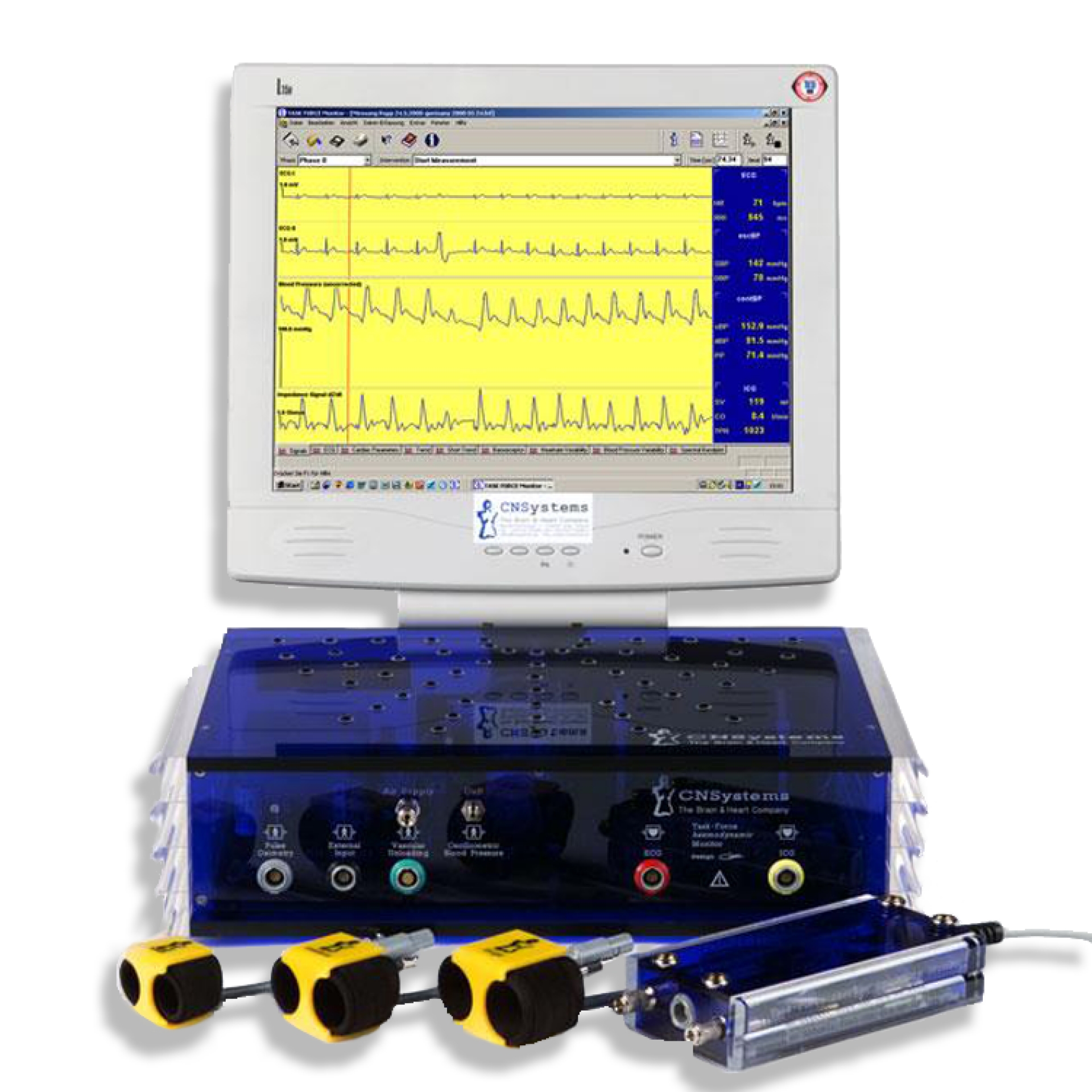 Monitoraggio non invasivo parametri vitali Task Force - Seda Spa